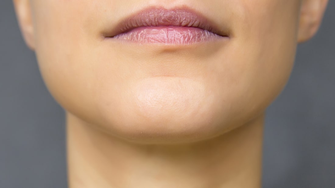 Types Of Cleft Chin