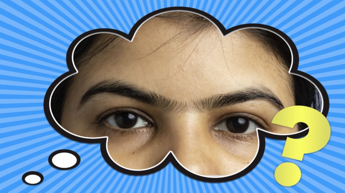What Is a Unibrow? (And What's the Best Way to Remove It?)